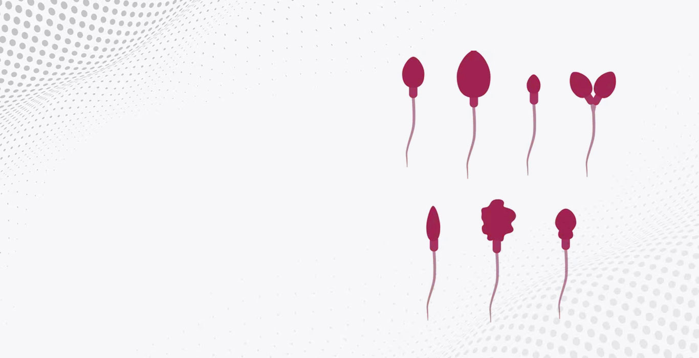 Abnormalities in Sperm: Sperm Abnormalities Types & Causes | Indira IVF