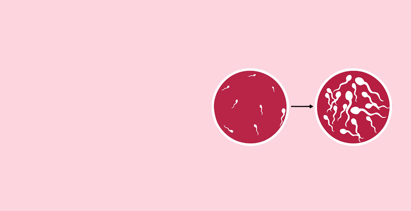 Oligospermia: Low Sperm Count Causes, Symptoms & Treatment | Indira IVF