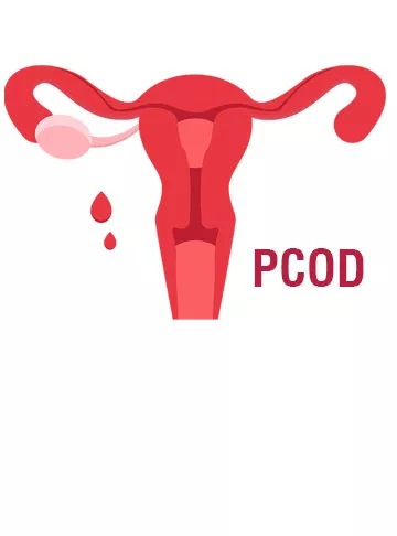 Polycystic Ovarian Disease (PCOD) – Diagnosis & Treatment | Indira IVF